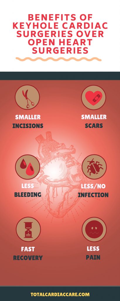 Benefits of keyhole surgeries | Total Cardiac Care | Dr Mahadevan